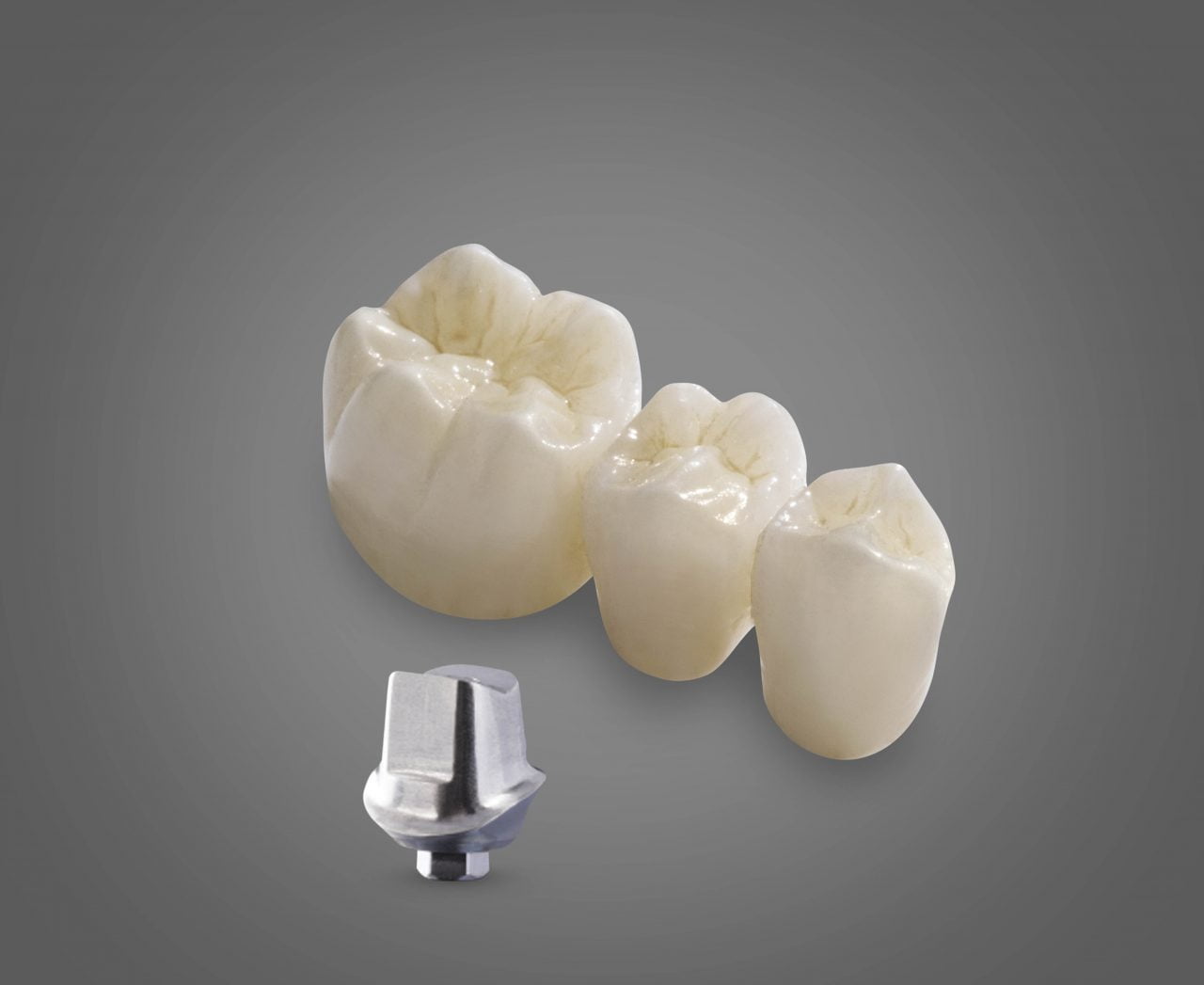 Prótese parcial fixa cimentada - Kion Dental