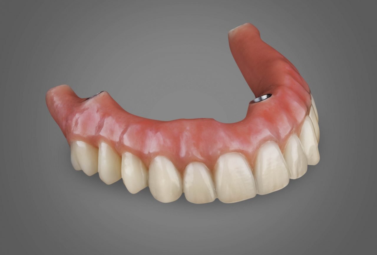 Portfólio Protocolos sobre Implante - Kion Dental
