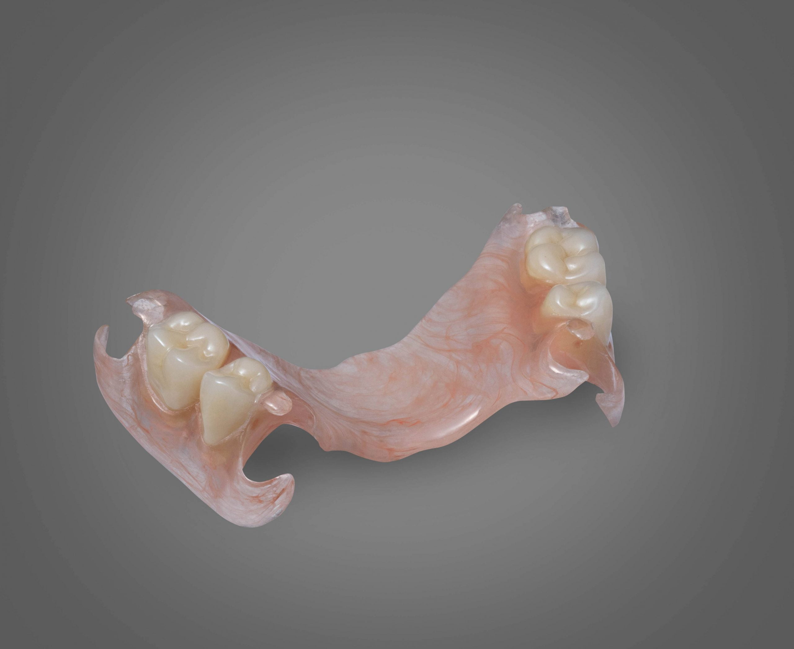 Prótese Flexível (Semirrígida Deflex) - Kion Dental