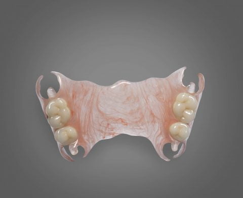 Prótese Flexível (Semirrígida Deflex) - Kion Dental