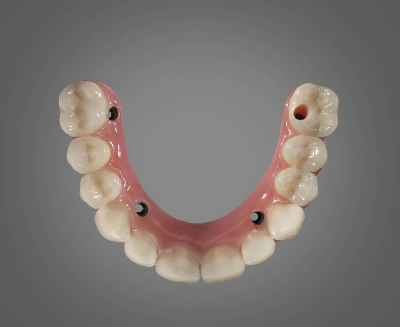 Protocolo Convencional - Kion Dental Technology